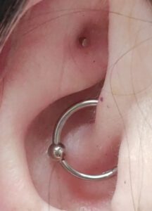 Acu piercing