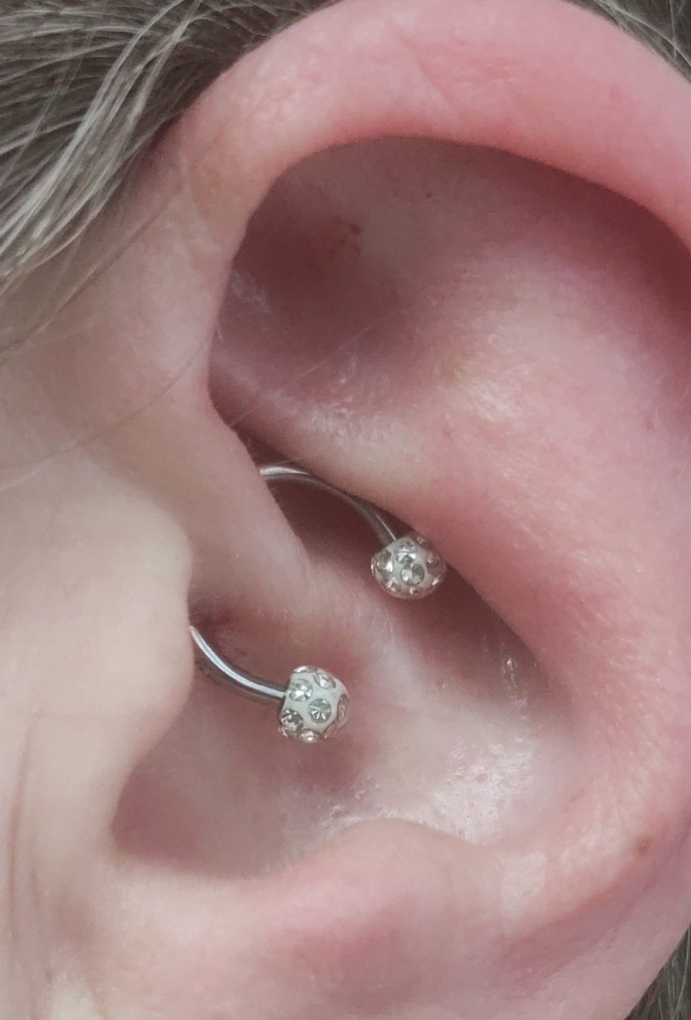 Medical Daith piercing - Daith Kliniek Eindhoven